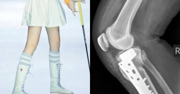 Bé gái 13 tuổi cao 1m72 do bà ngoại kiên trì làm 4 điều theo lời bác sĩ ...